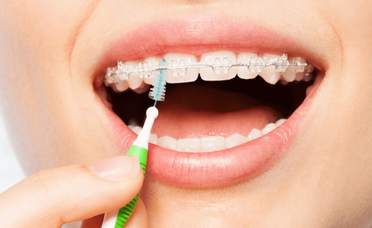 Restoring Gum Health Naturally with Effective Strategies - Gum Disease Cure